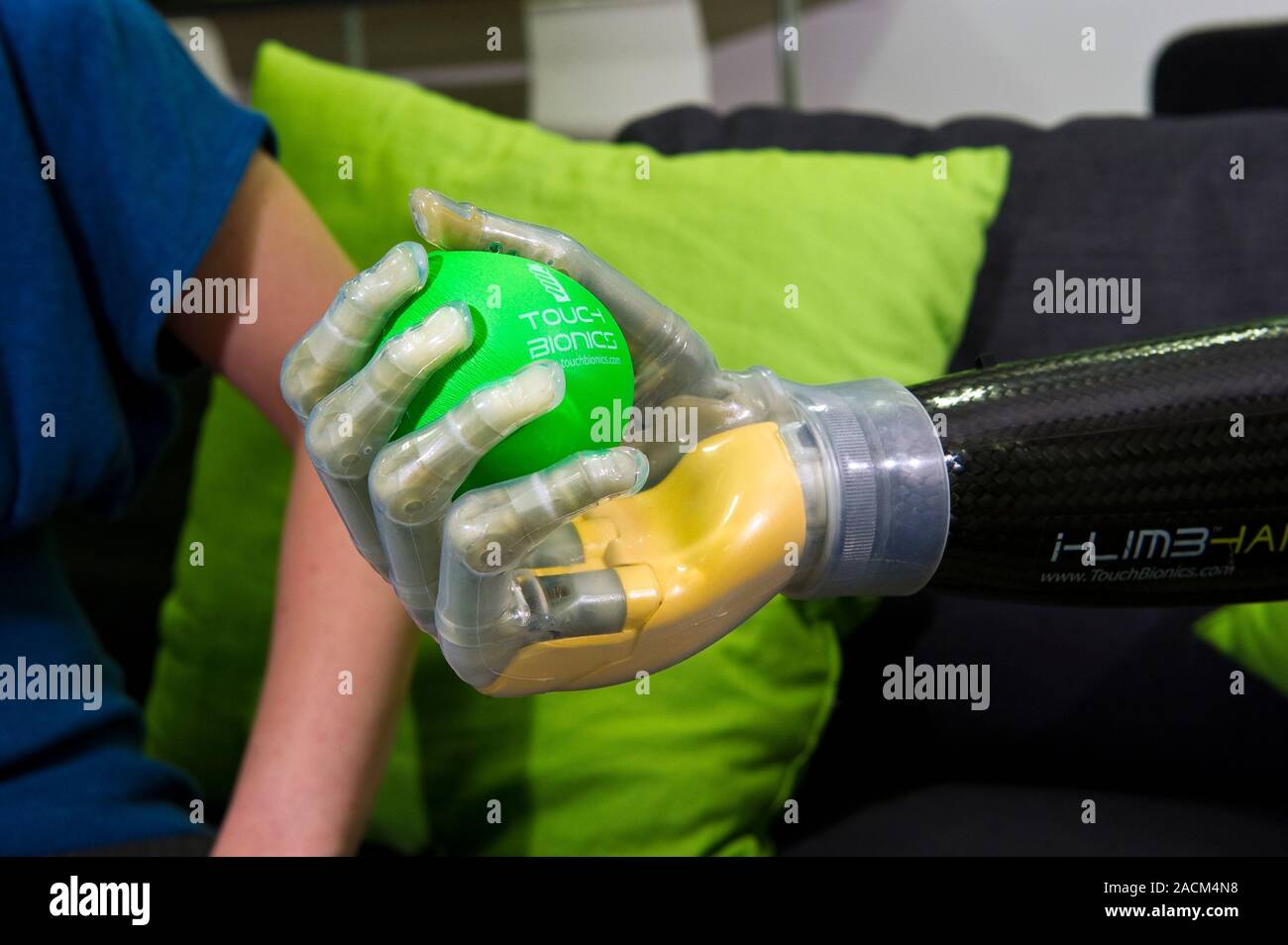 i-LIMB bionic hand, fitted with a protective glove, being used to grasp ...