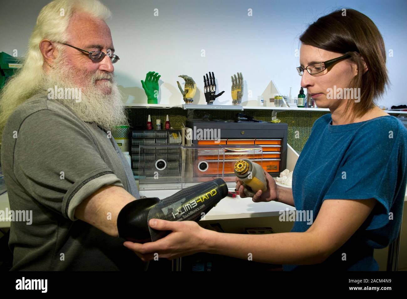 i-LIMB bionic hand being attached to its forearm component. This is the ...
