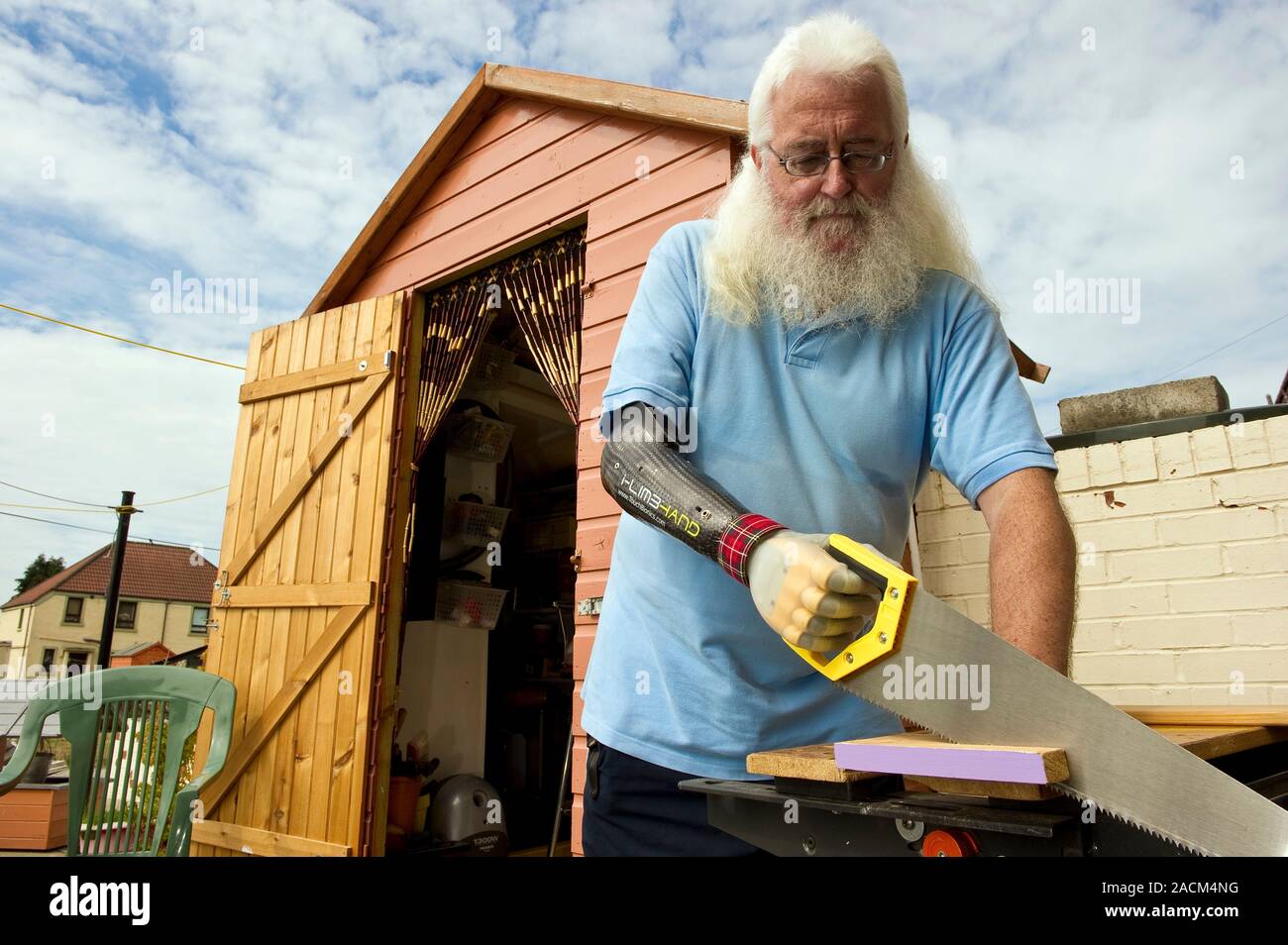 i-LIMB bionic hand being used by Donald McKillop to saw wood. This is ...