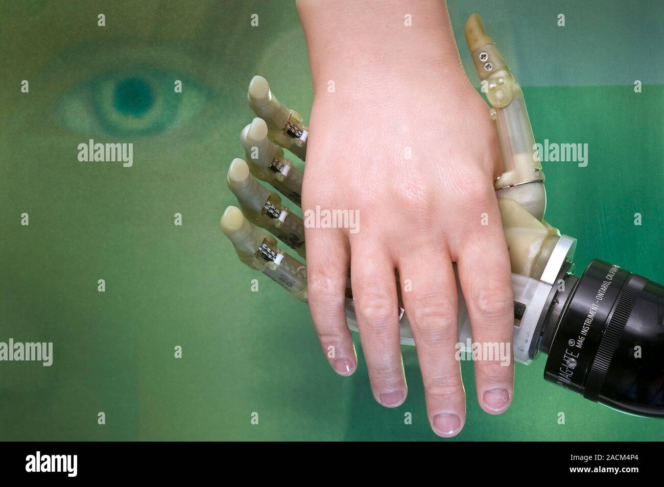 i-LIMB bionic hand and skin prosthesis. The i-LIMB range of bionic ...