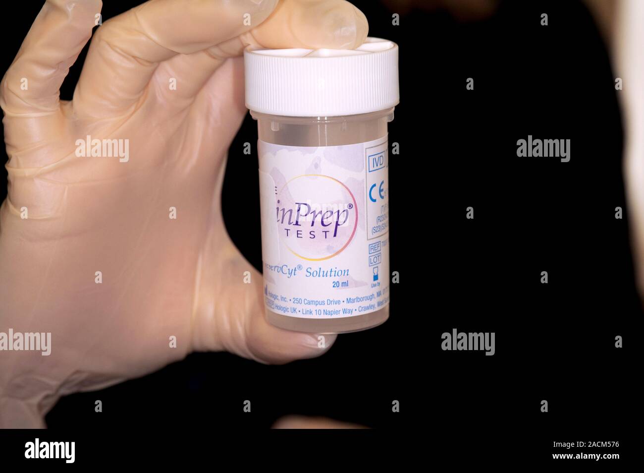 Gloved hand holds a bottle of cervical smear (PAP) fluid into which a ...