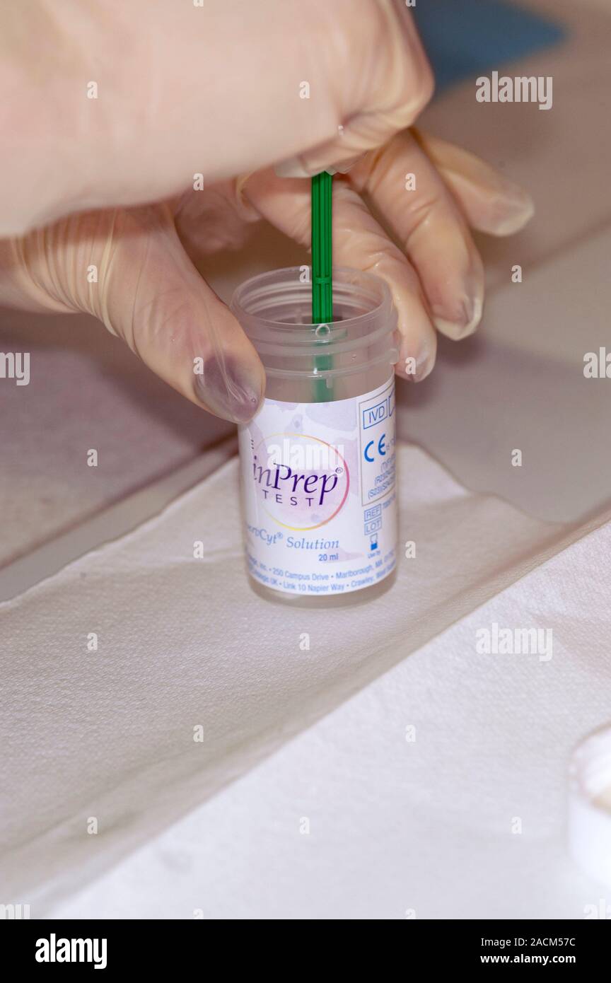 Gloved hand places a sample stick containing cervical cells into a ...