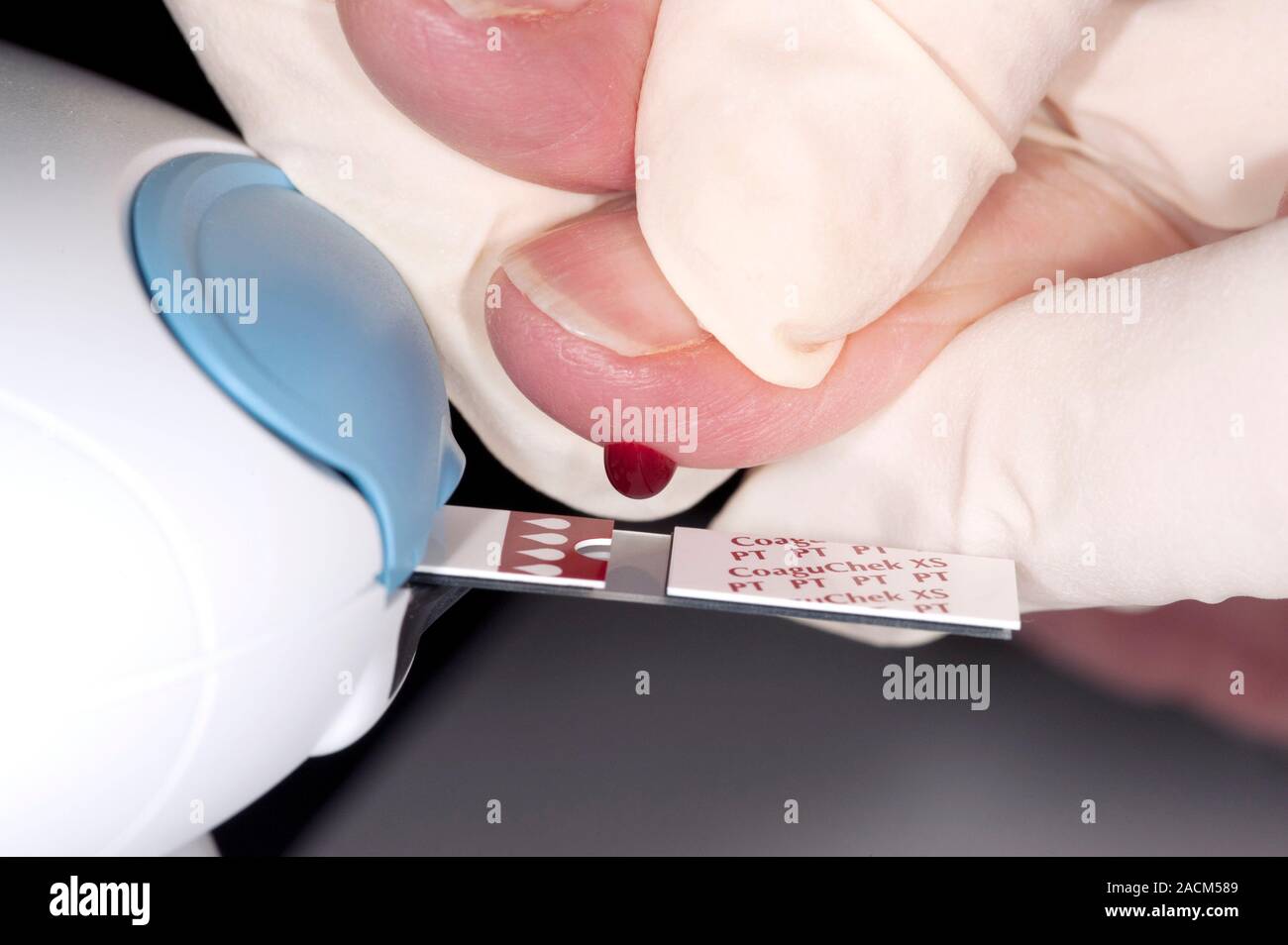 Drop of blood from a fingertip is placed on the diagnostic strip of a ...