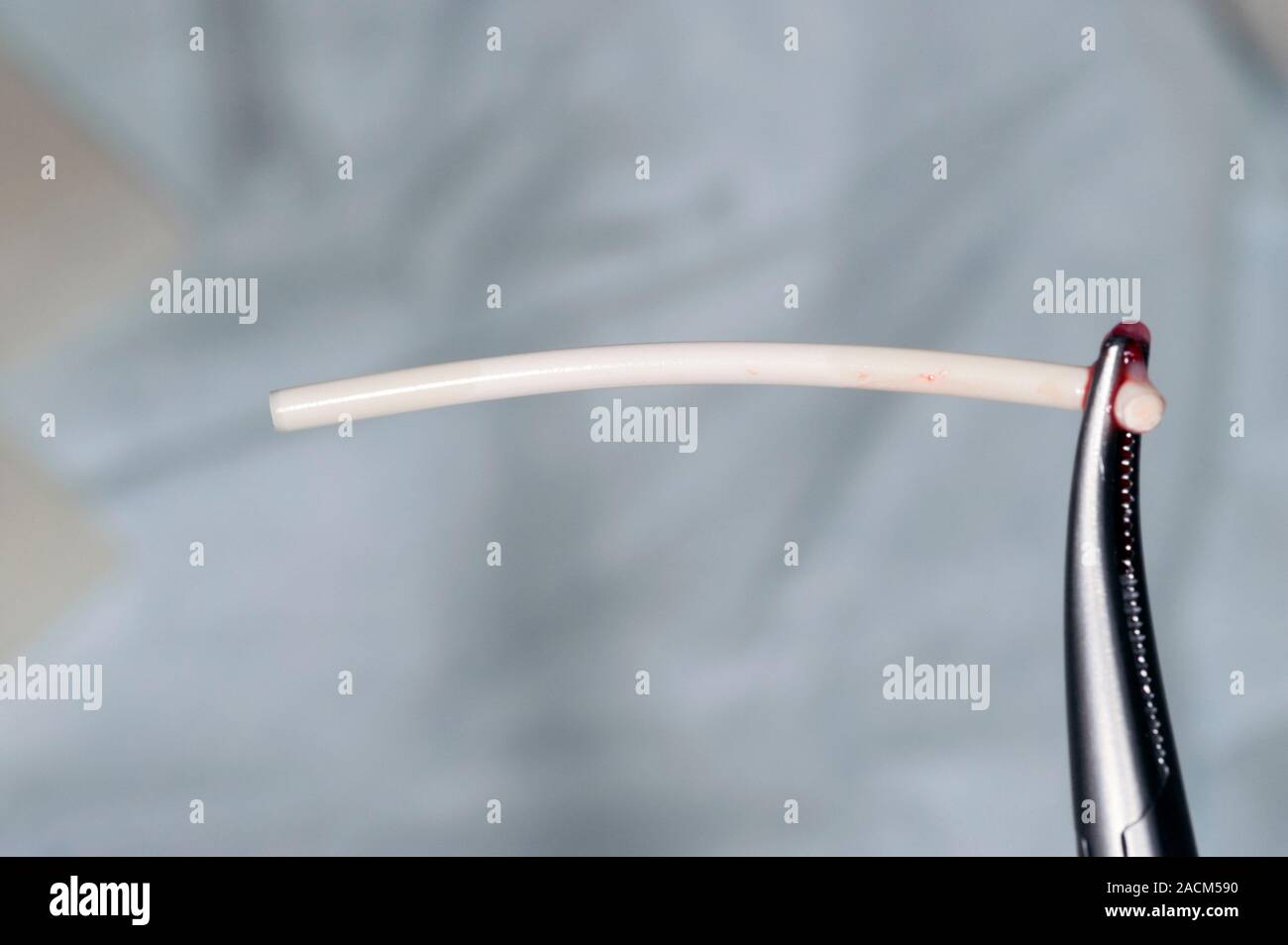 Surgical forceps holds an Implanon contraceptive implant placed under ...