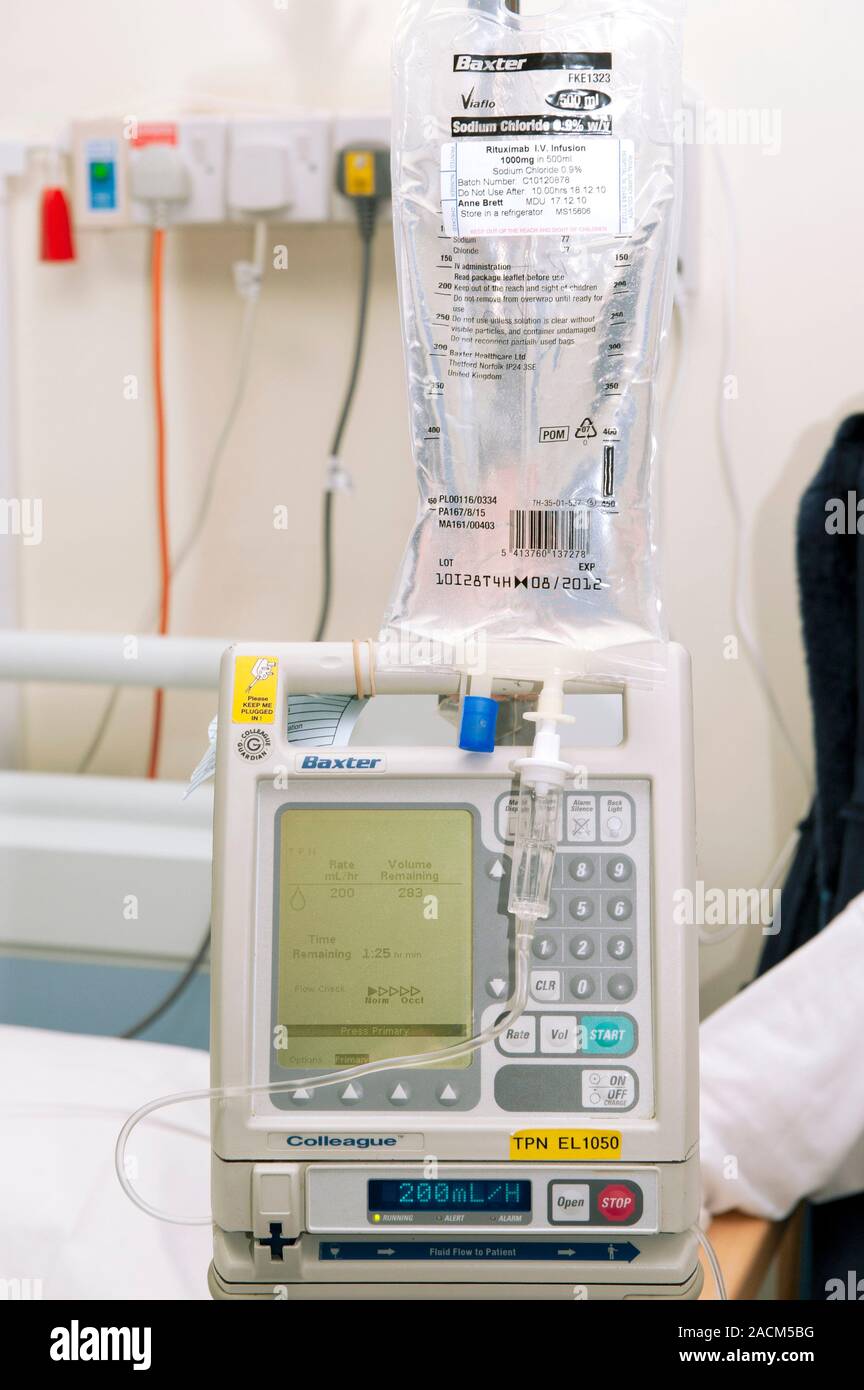 Intravenous infusion (IV drip) of the drug Rituximab into the arm of an ...