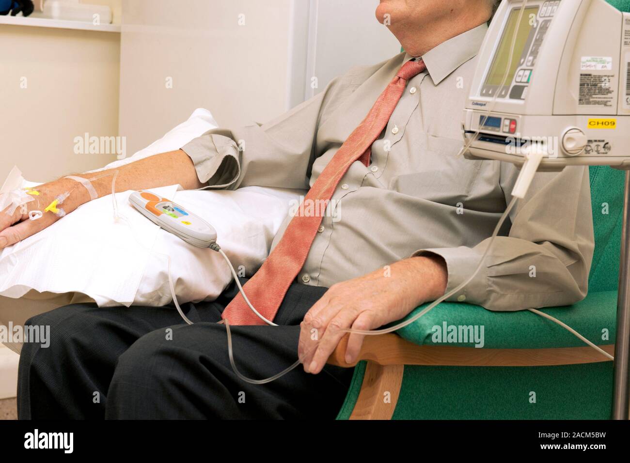 Cannula inserted into a vein of the hand (at left) to administer an ...