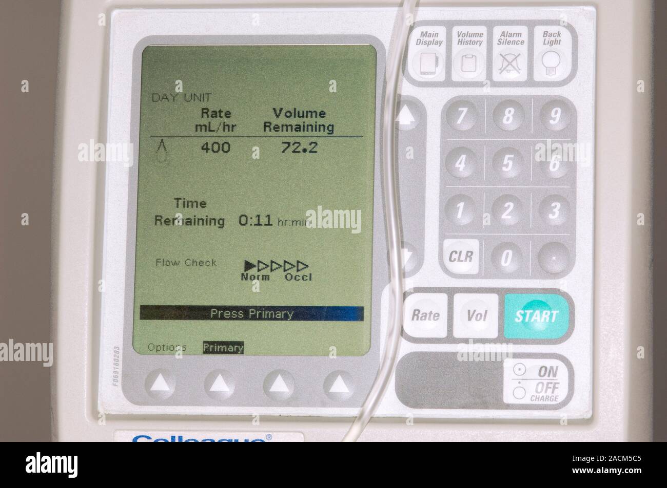 Drug monitor showing the administration of an intravenous chemotherapy ...