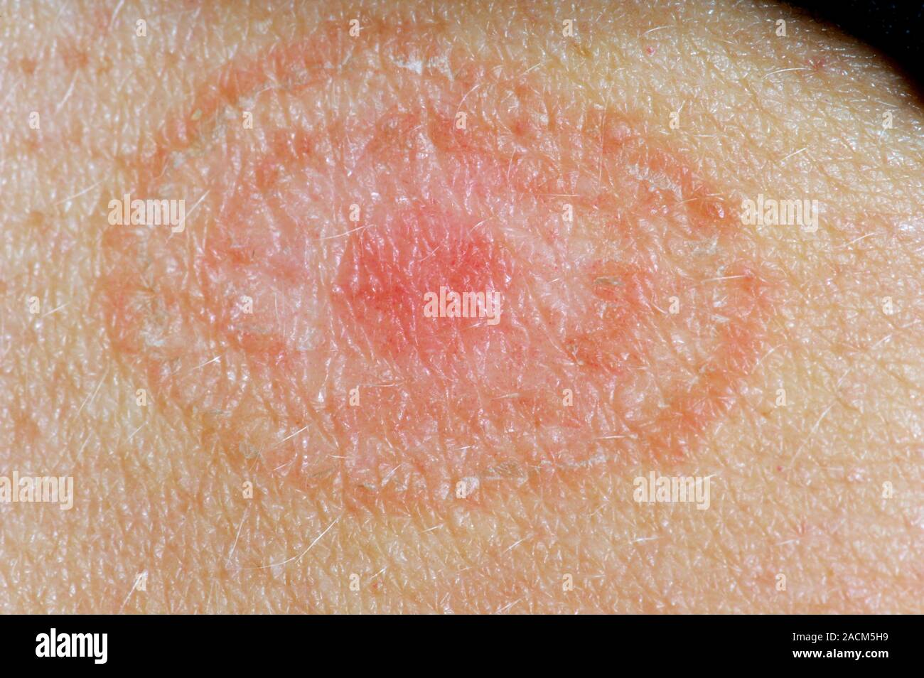 Not for use in Television Not for use in Television Close-up of ...