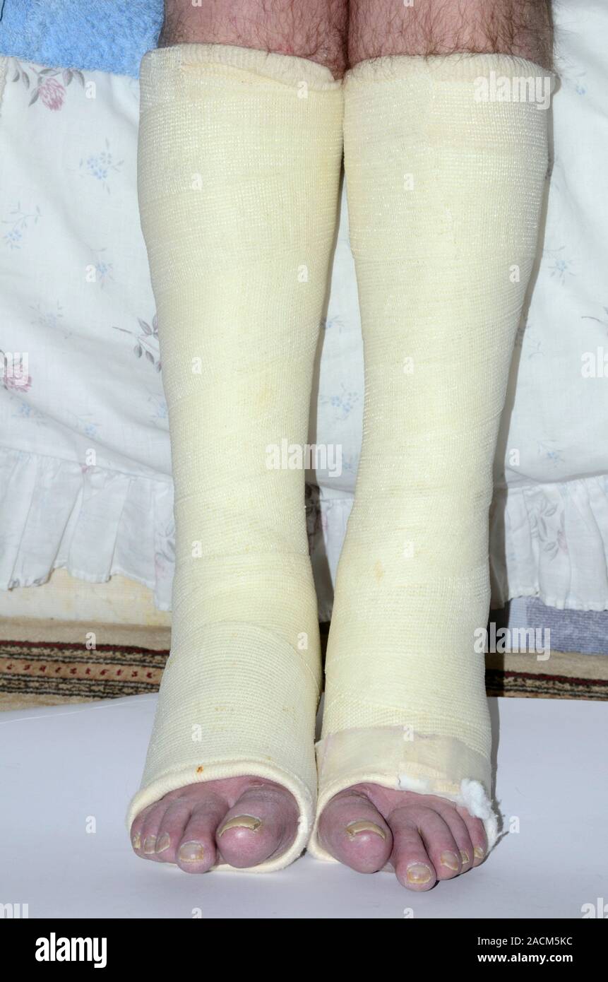 Not for use in Television Not for use in Television Plaster casts ...