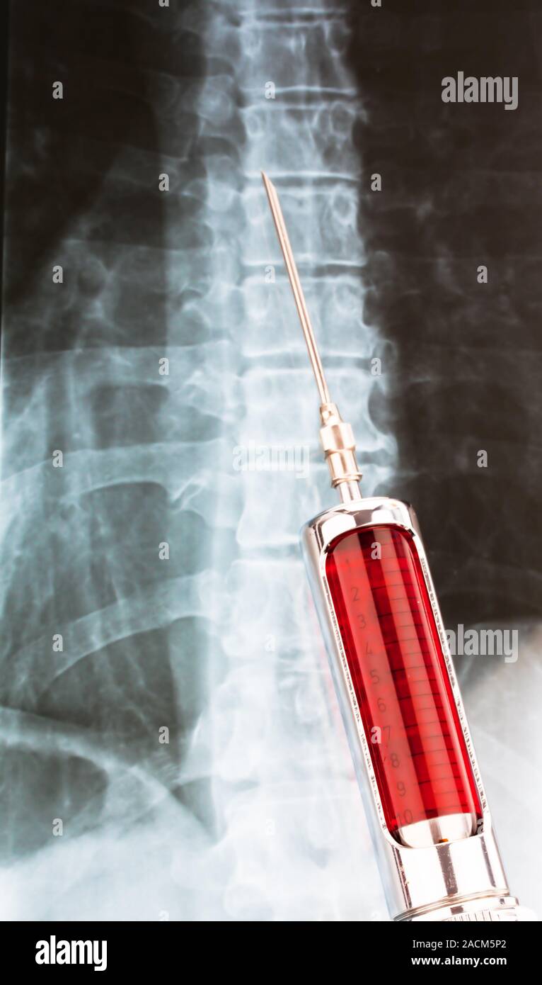 Injection needle and syringe with X-ray image Stock Photo - Alamy