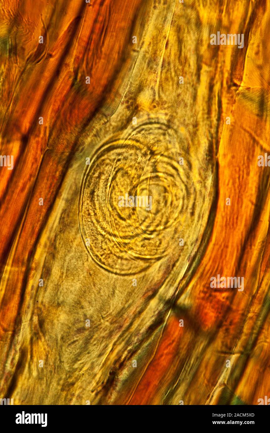 Nematode larval cyst. Light micrograph of a section through muscle ...