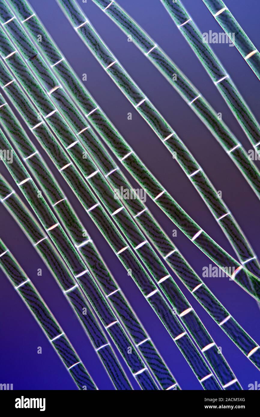 Spirogyra algae. Polarised light micrograph of Spirogyra sp. algae ...