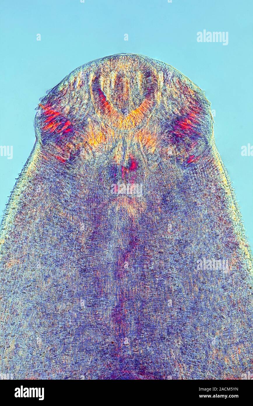 Fluke worm. Light micrograph of a section through the head of an ...