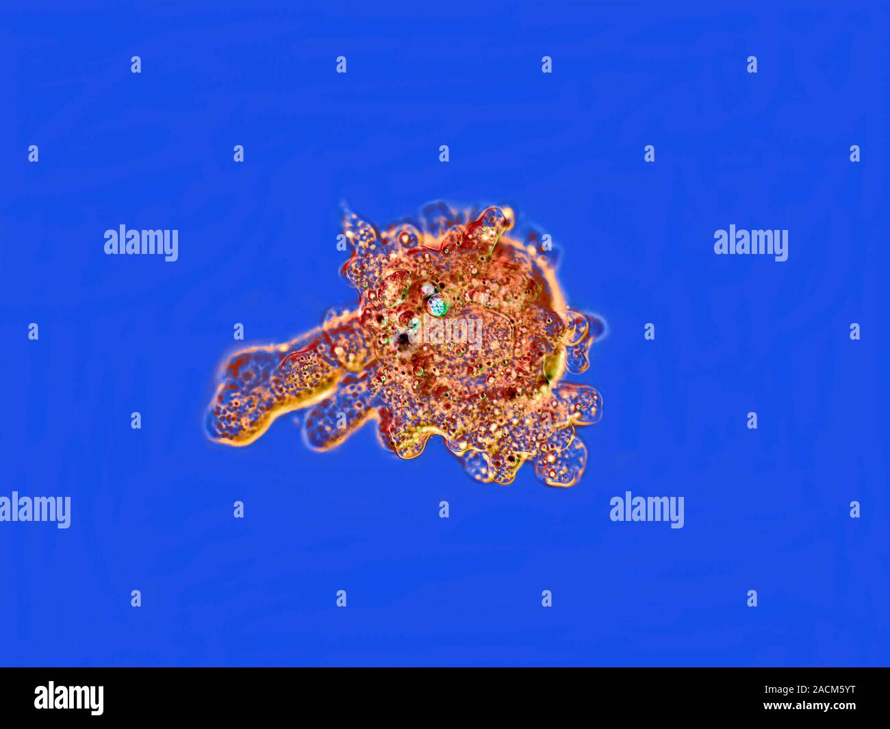 Proteus amoeba. Differential interference contrast micrograph of an Amoeba proteus protozoan ...
