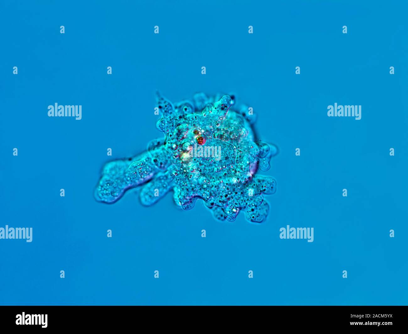 Proteus amoeba. Differential interference contrast micrograph of an Amoeba proteus protozoan ...