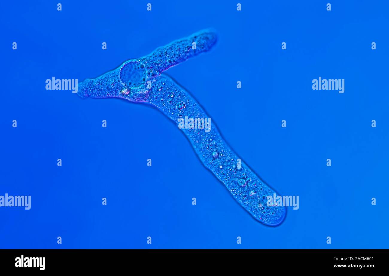 Proteus amoeba. Differential interference contrast micrograph of an ...
