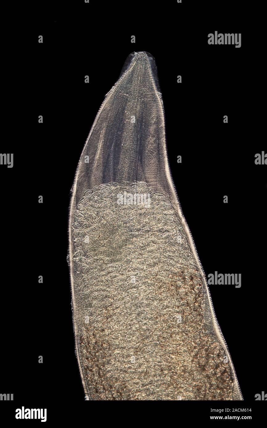 Threadworm. Light micrograph of a female Enterobius vermicularis ...