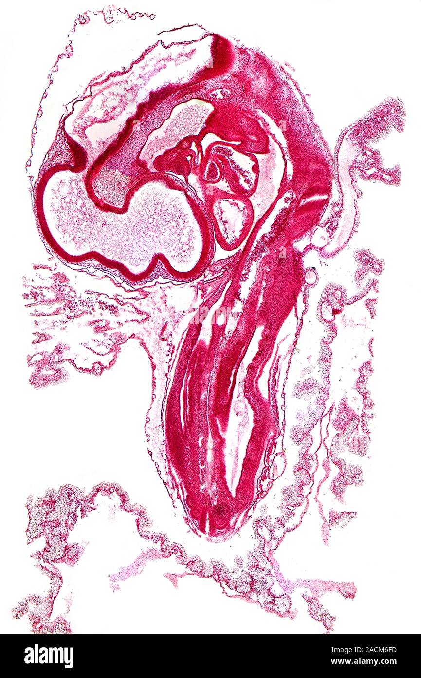 Chicken embryo. Light micrograph of a longitudinal section through a 3 ...