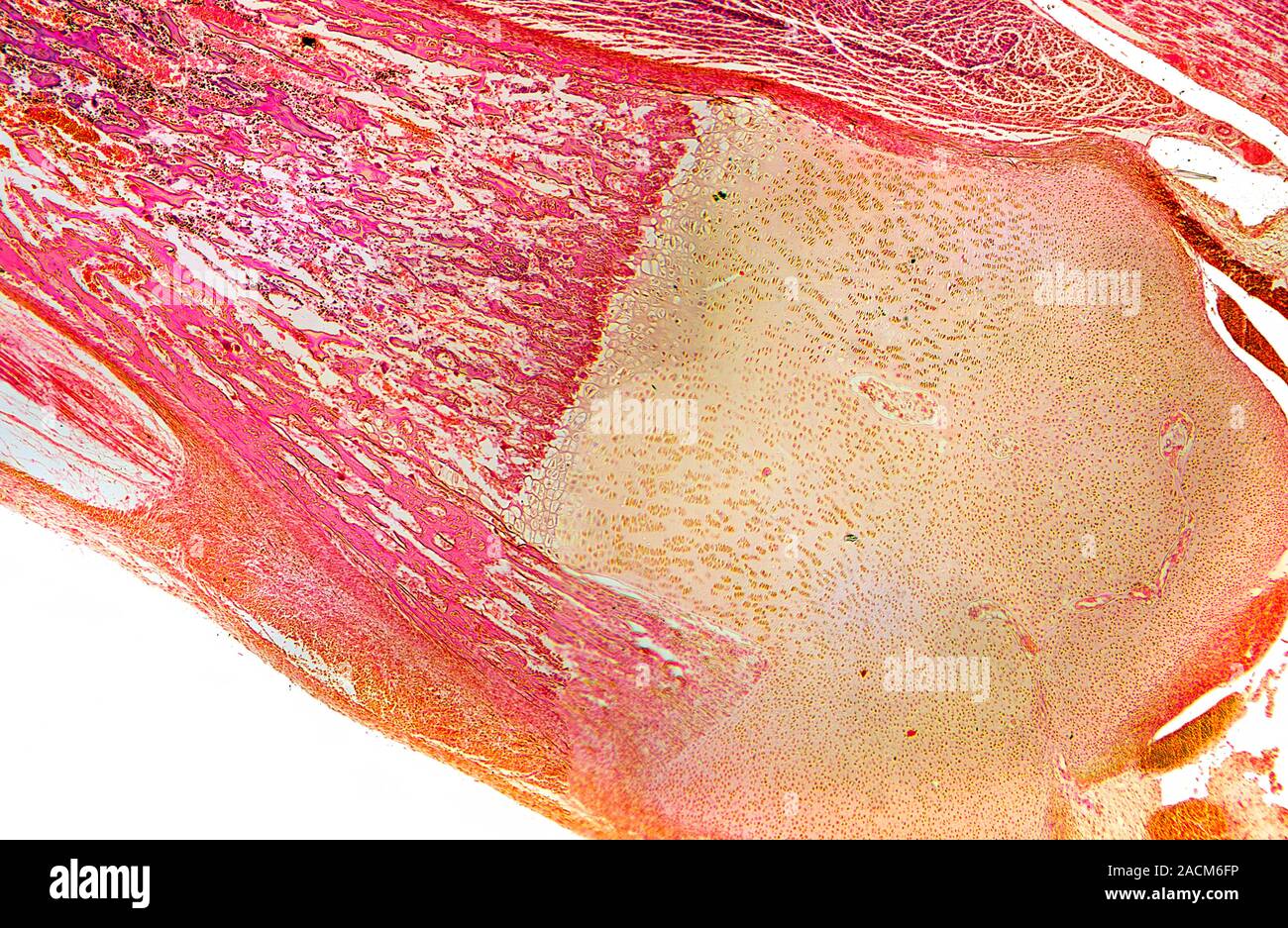Foetal bone formation. Light micrograph of a longitudinal section ...