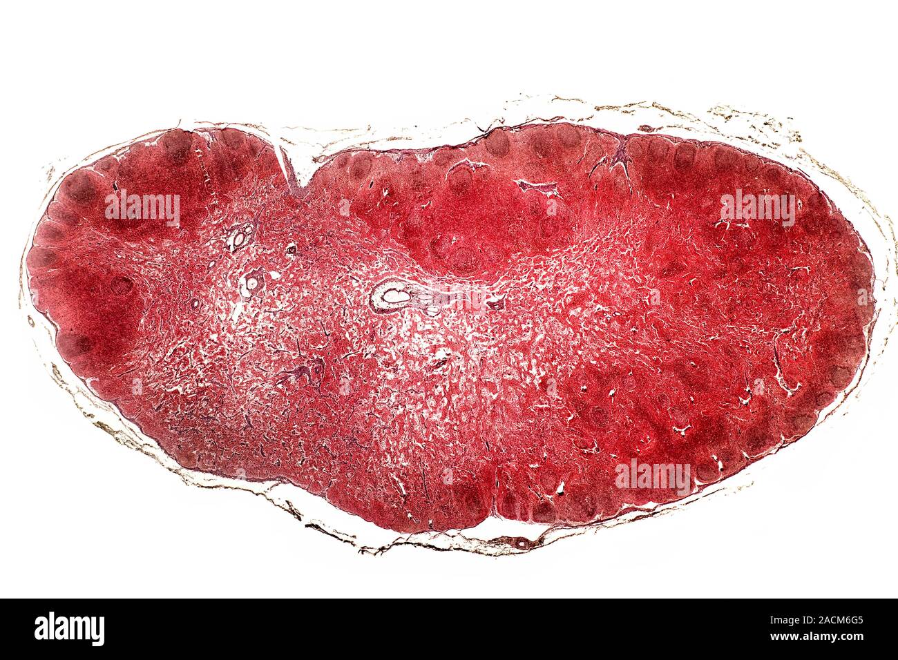 Lymph gland. Light micrograph of a transverse section through a lymph ...