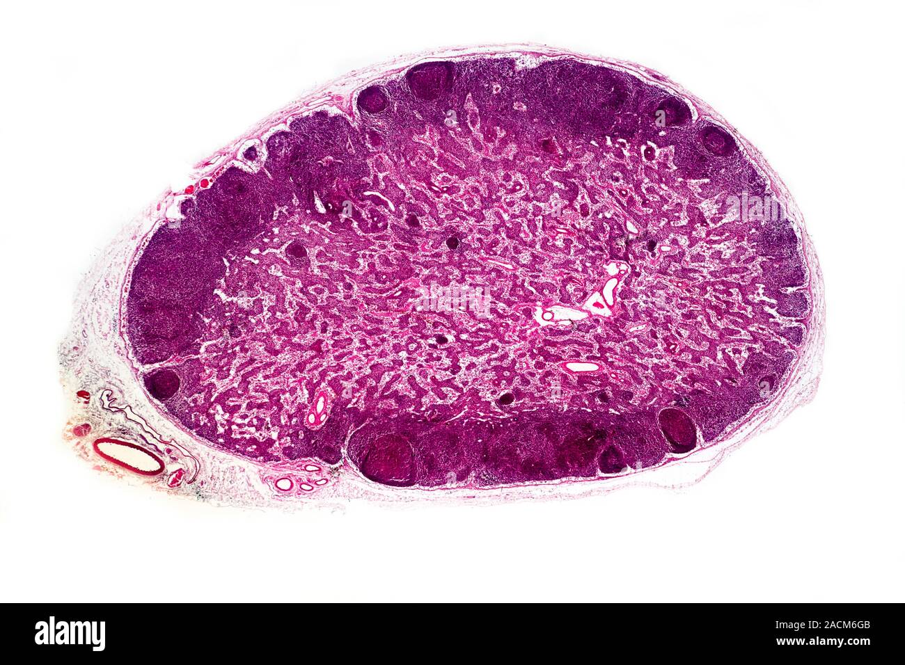 Lymph gland. Light micrograph of a transverse section through a lymph ...