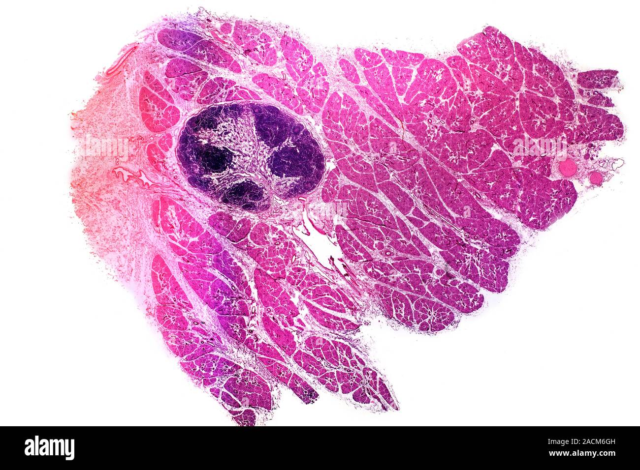 Parotid salivary gland. Light micrograph of a transverse section ...