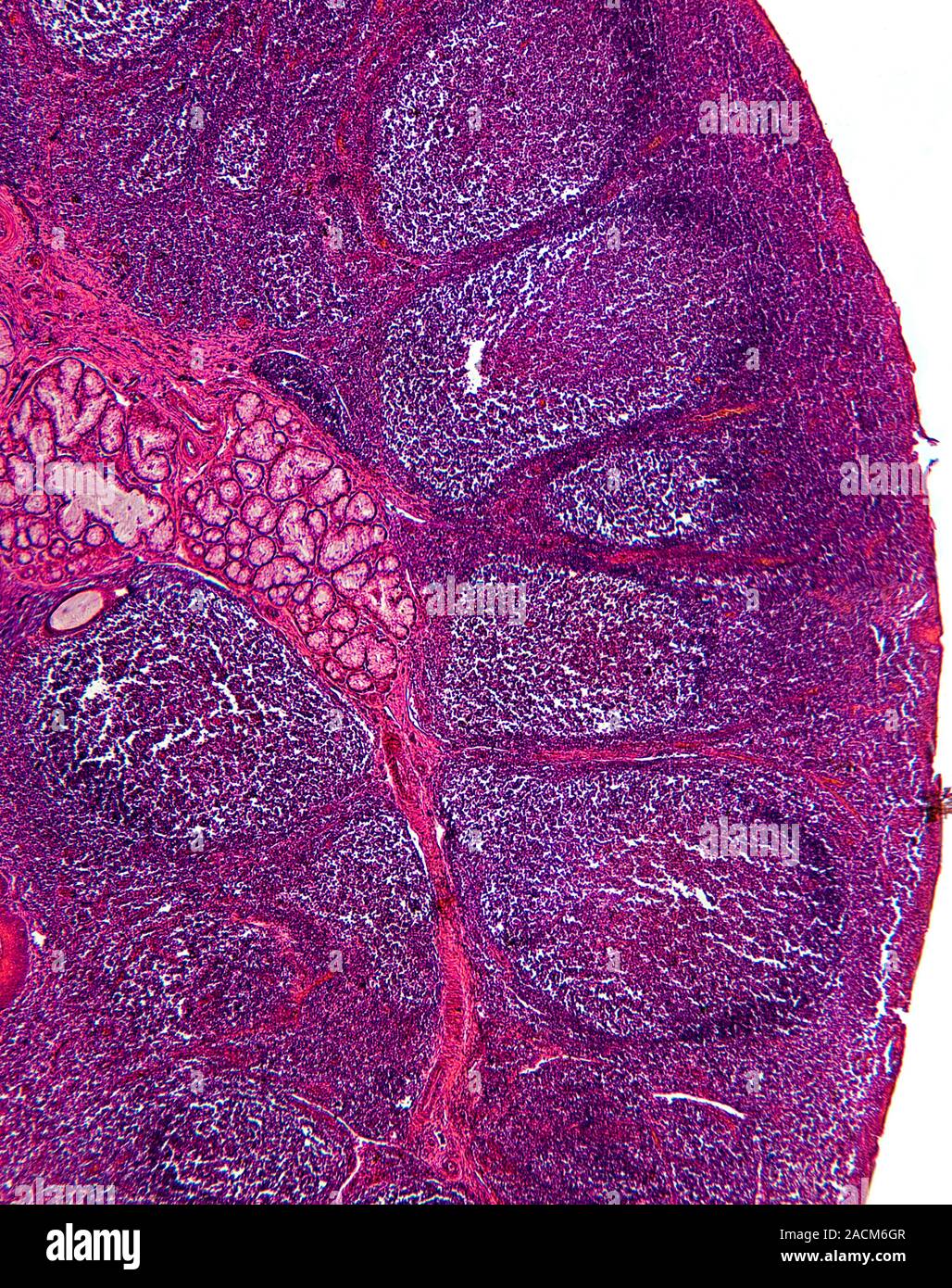 Tonsil tissue. Light micrograph of a transverse section through tissue ...