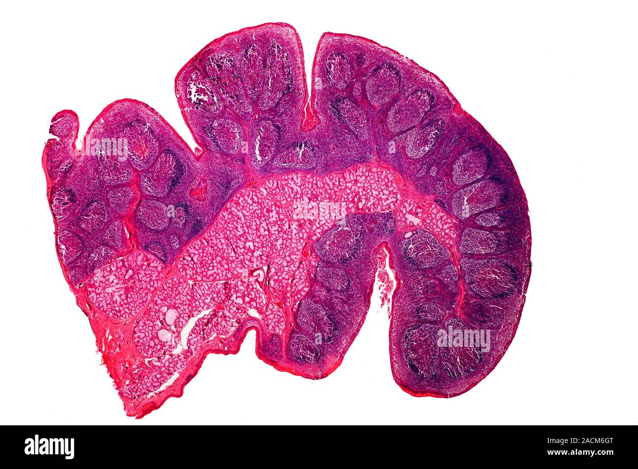 Tonsil tissue. Light micrograph of a transverse section through tissue ...