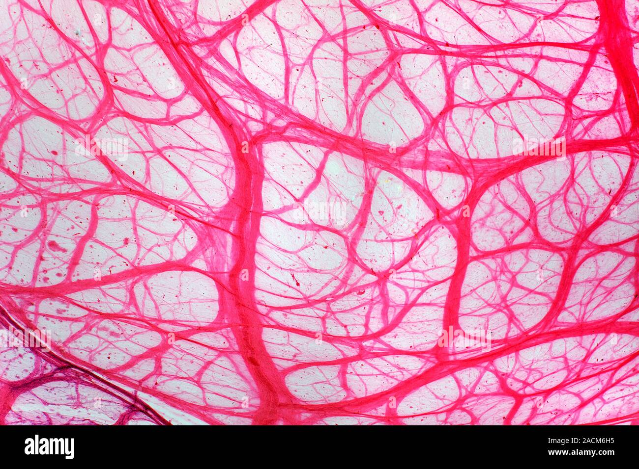 Bladder tissue. Light micrograph of stretched tissue from the wall of ...