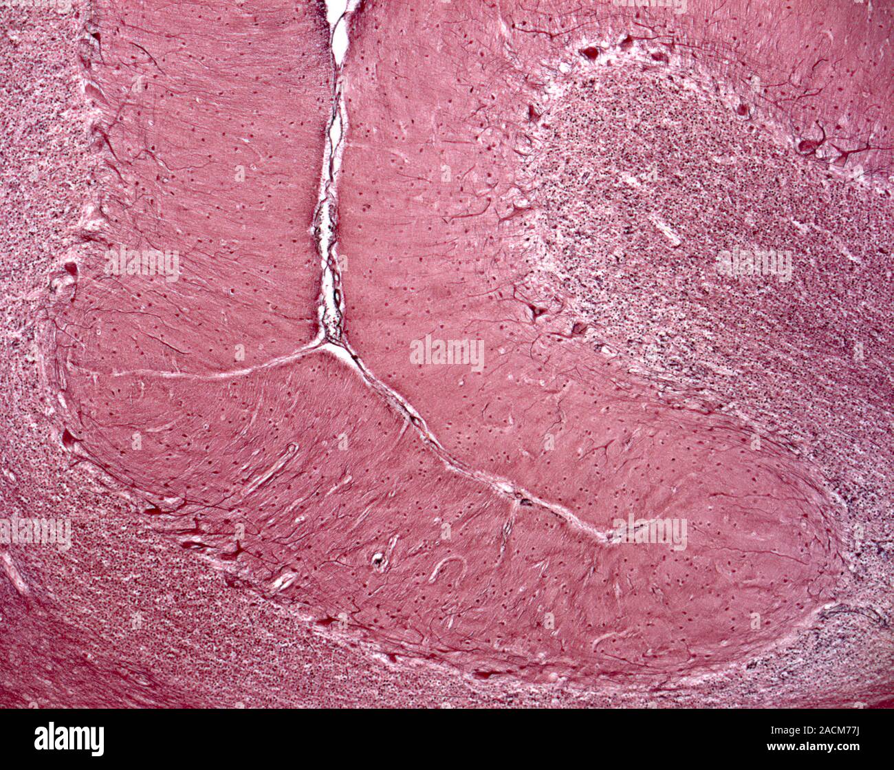 Cerebellum tissue, light micrograph. This close-up of a section through ...