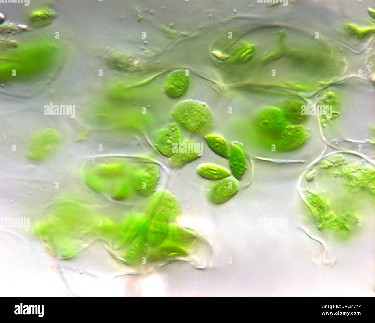 Chloroplasts, light micrograph. Chloroplasts are one of the features ...