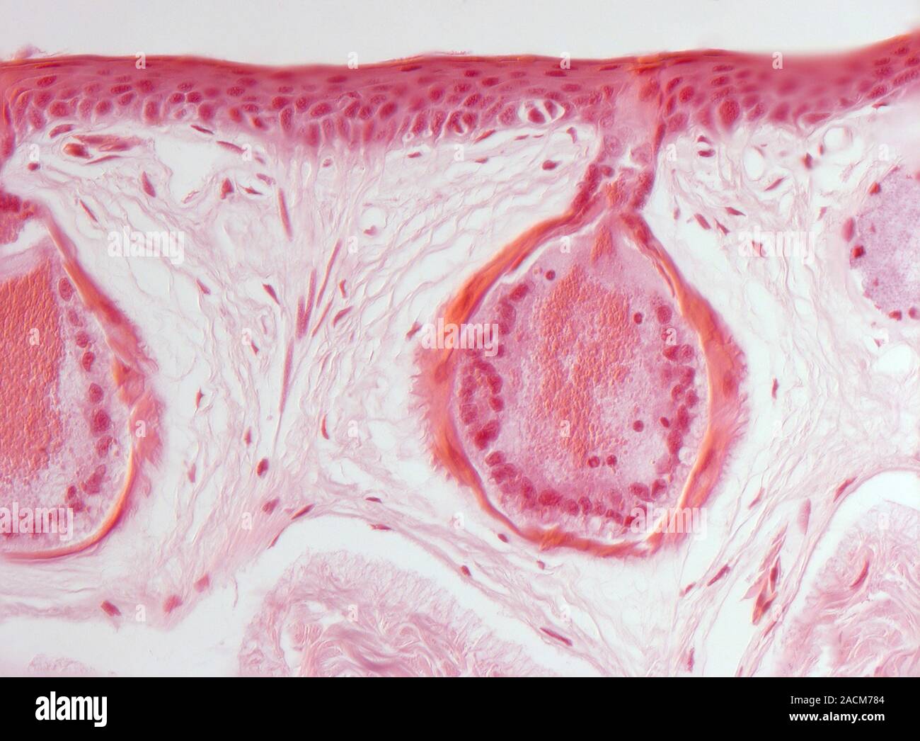 Frog skin glands. Light micrograph of a section through the skin of a ...