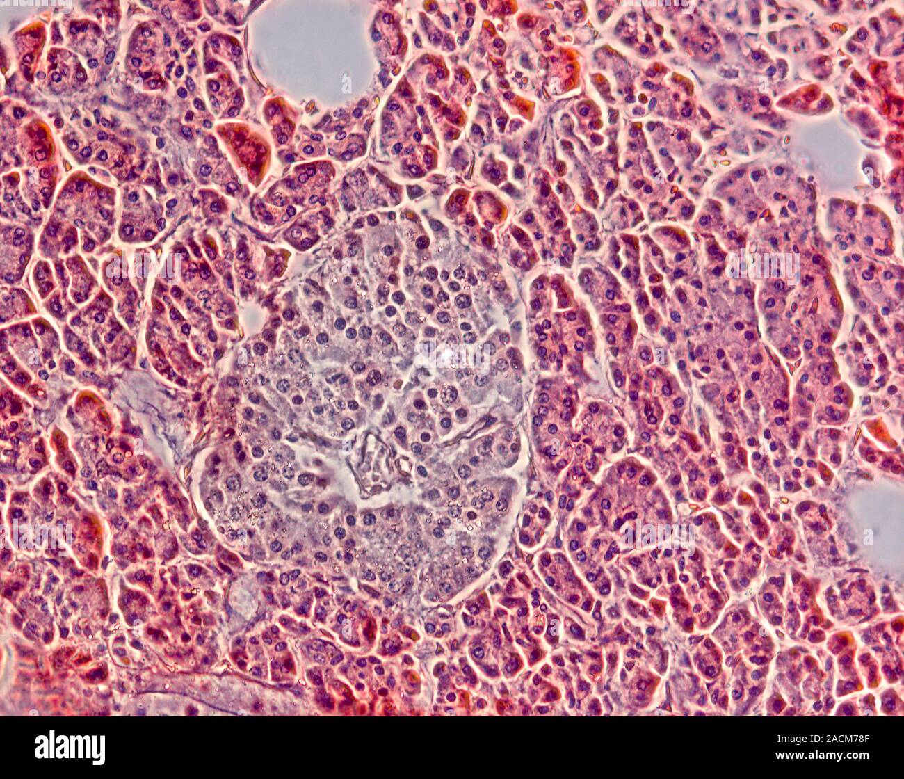 Islet of Langerhans. Light micrograph of a section through an islet of ...