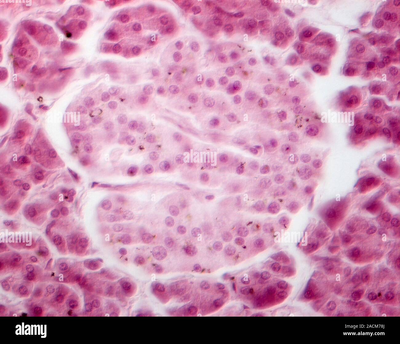 Islet of Langerhans. Light micrograph of a section through an islet of ...