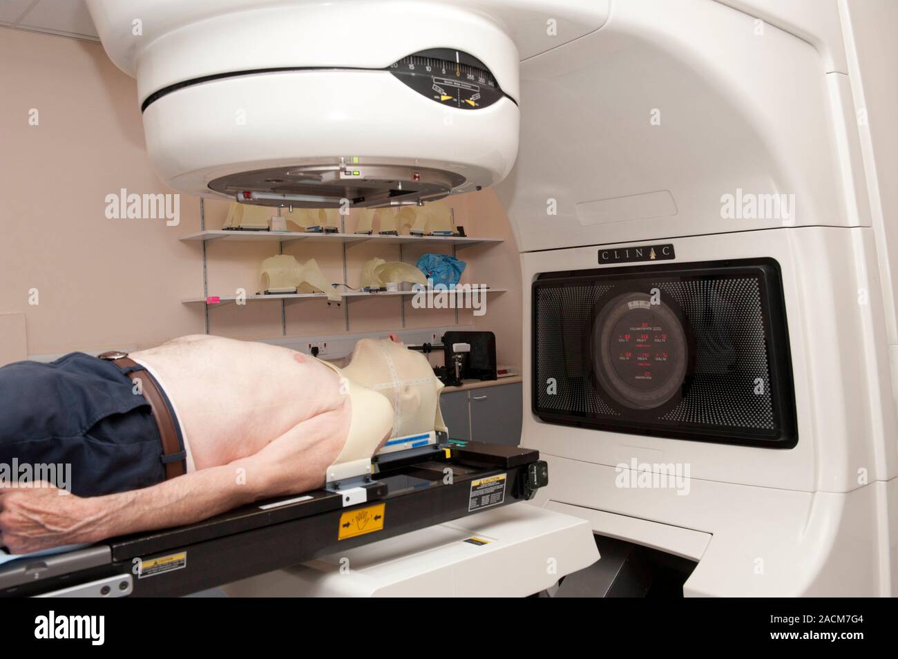 Mask covers the head and neck of an 80 year old male patient undergoing radiotherapy (radiation ...