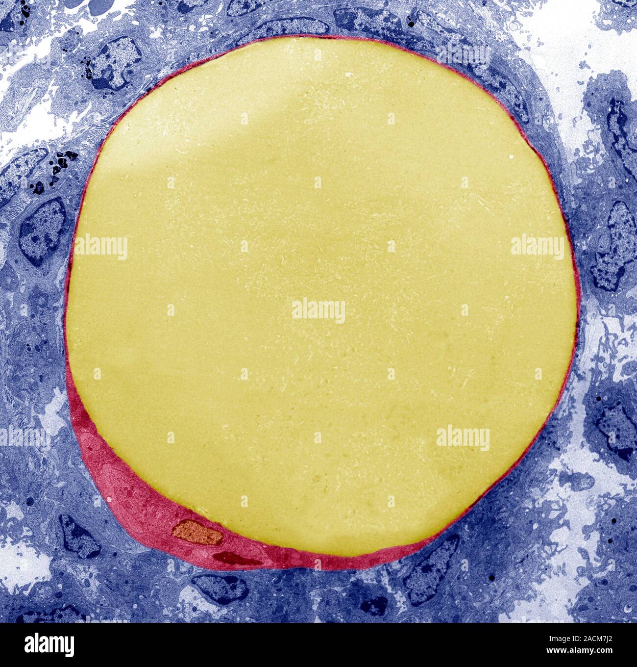 Fat cell. Coloured Coloured transmission electron micrograph (TEM) of a ...