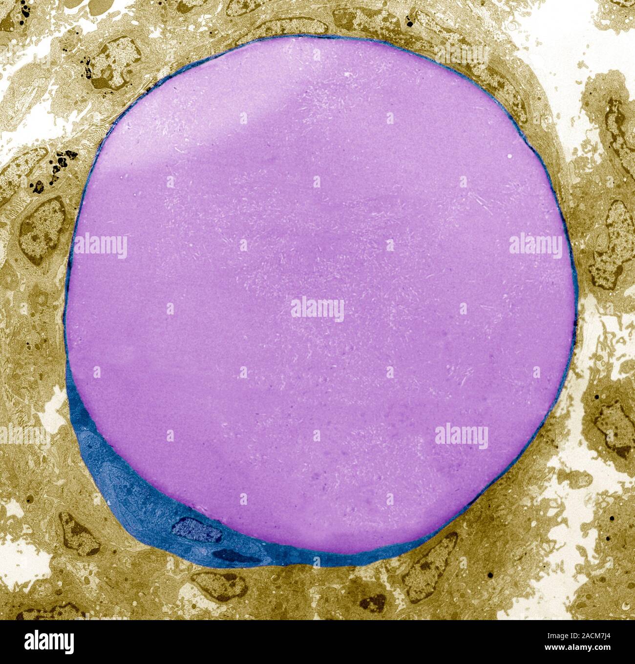Fat cell. Coloured Coloured transmission electron micrograph (TEM) of a ...