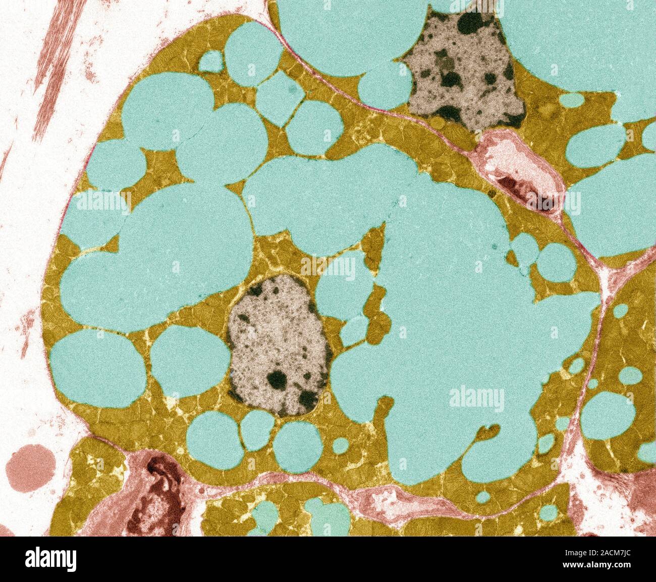 Fat cells. Coloured Coloured transmission electron micrograph (TEM) of ...