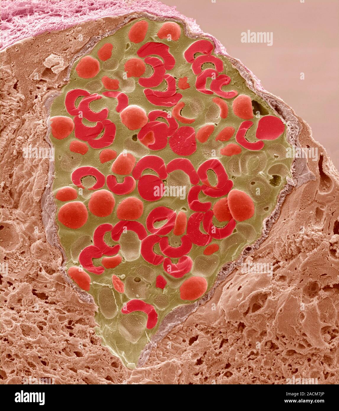 Retina blood vessel. Coloured scanning electron micrograph (SEM) of a ...