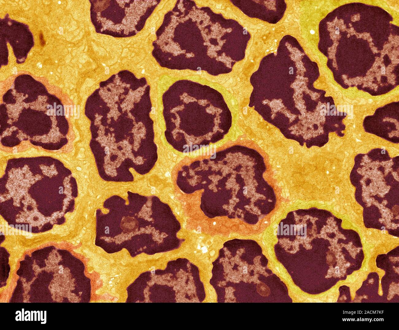 Lymph node. Coloured transmission electron micrograph (TEM) of a ...
