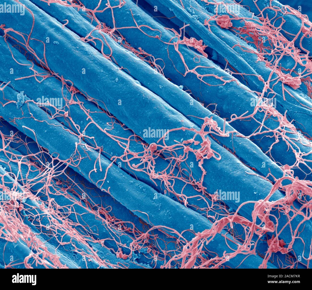 Optic nerve fibres. Coloured scanning electron micrograph (SEM) of ...