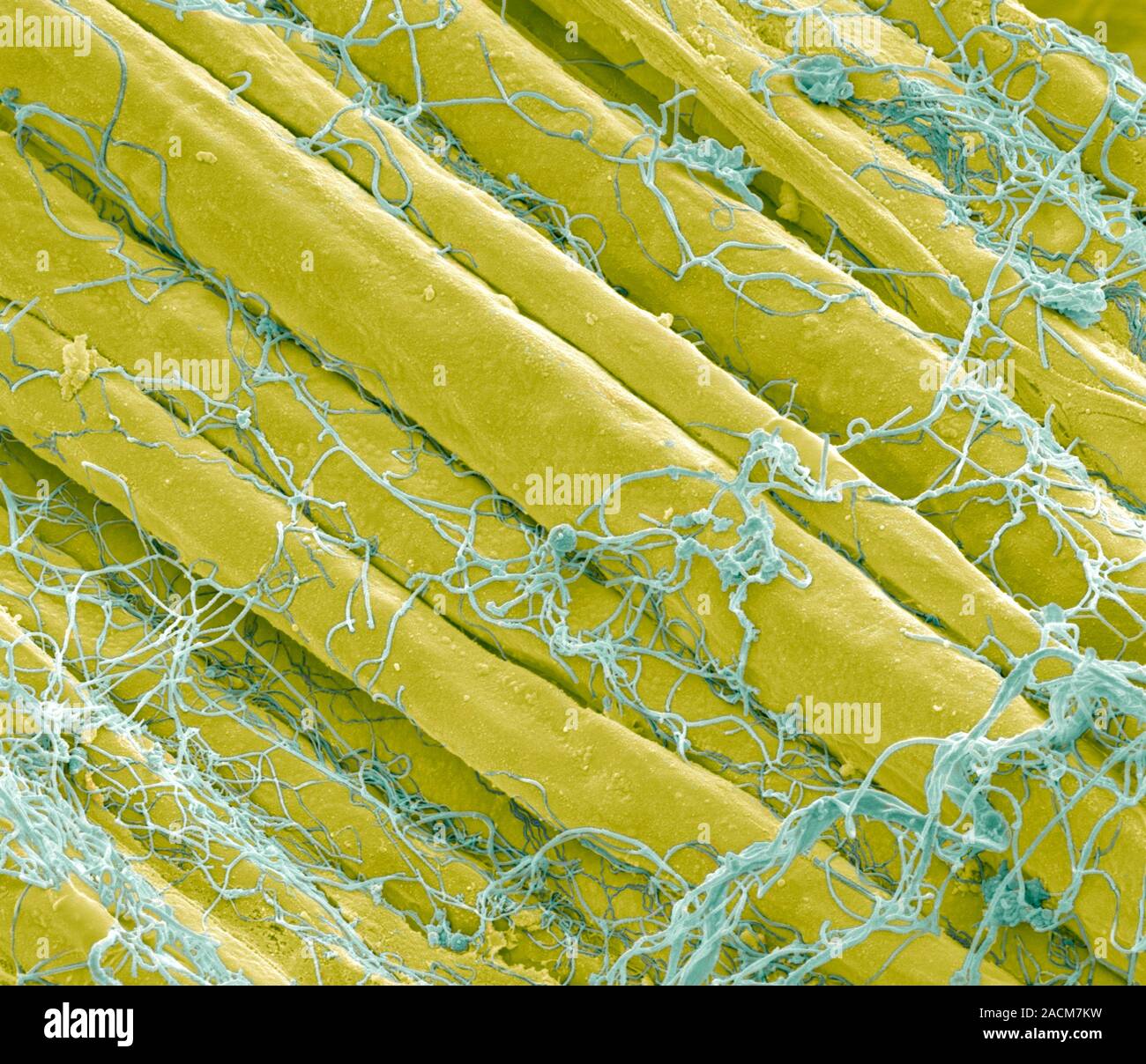 Optic nerve fibres. Coloured scanning electron micrograph (SEM) of ...