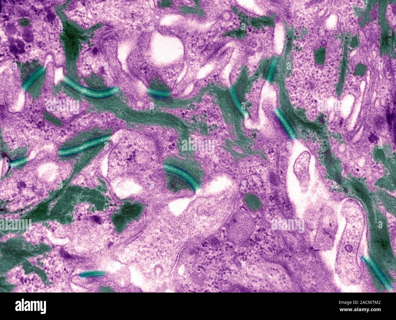 Skin cell desmosomes. Coloured transmission electron micrograph (TEM ...