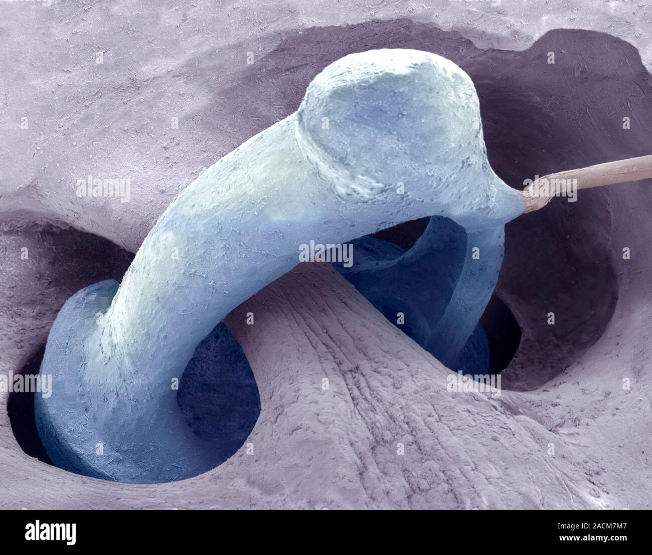 Middle ear bone. Coloured scanning electron micrograph (SEM) of the ...