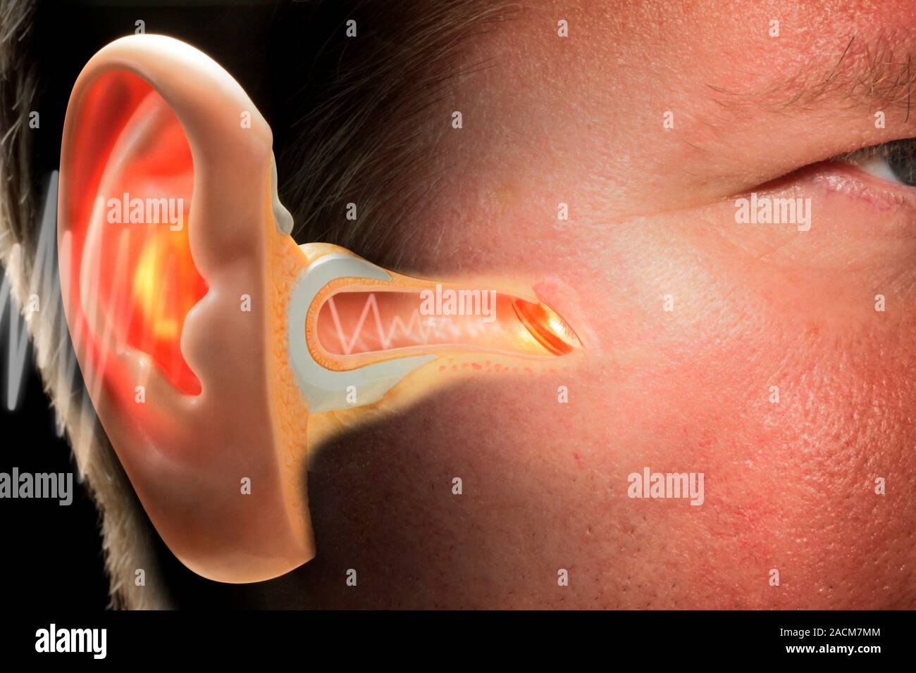 Hearing, conceptual image. Composite artwork showing soundwaves ...