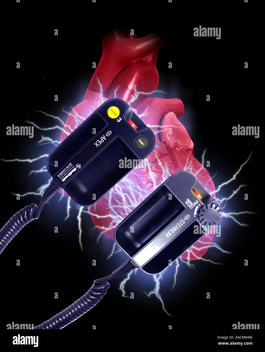 Paddles of a defibrillator producing an electric discharge on an image ...