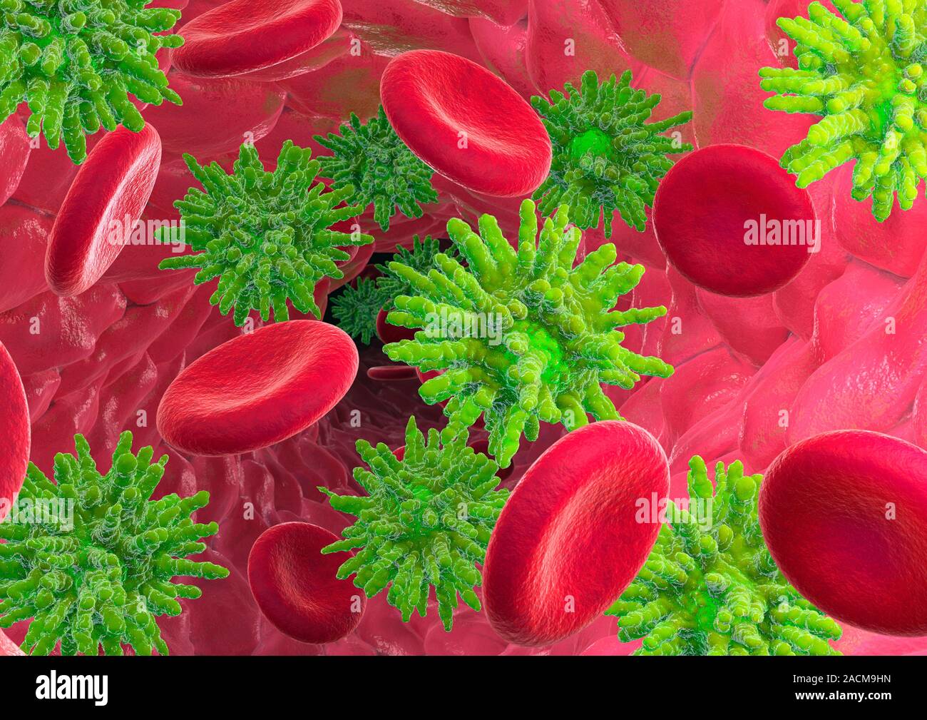 Blood cancer, conceptual image. Computer artwork of the interior of a ...