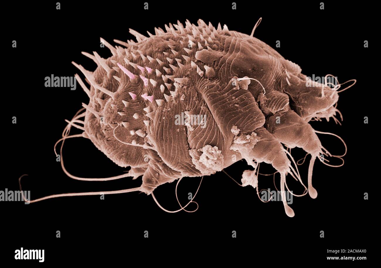 Scabies mite (Sarcoptes scabiei), coloured scanning electron micrograph ...