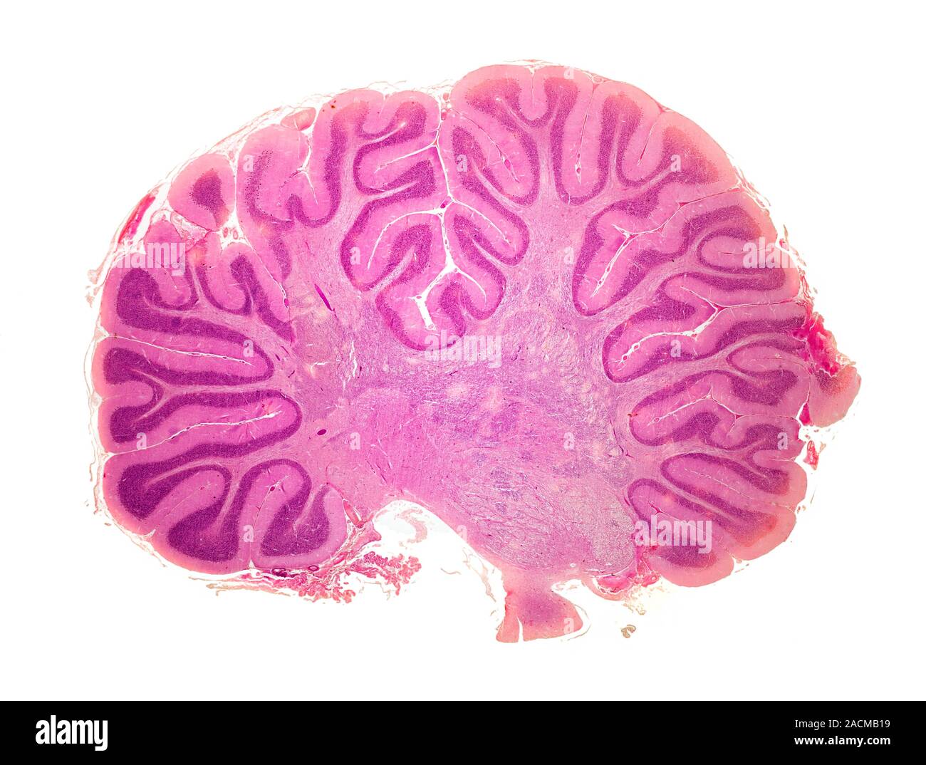 Cerebellum. Light micrograph of a section through the cerebellum of the ...