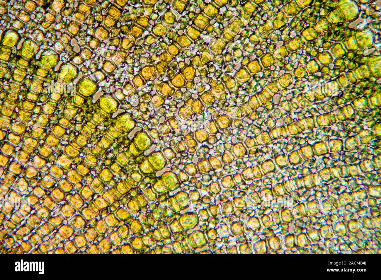 Sea urchin spine. Phase contrast light micrograph of a transverse ...